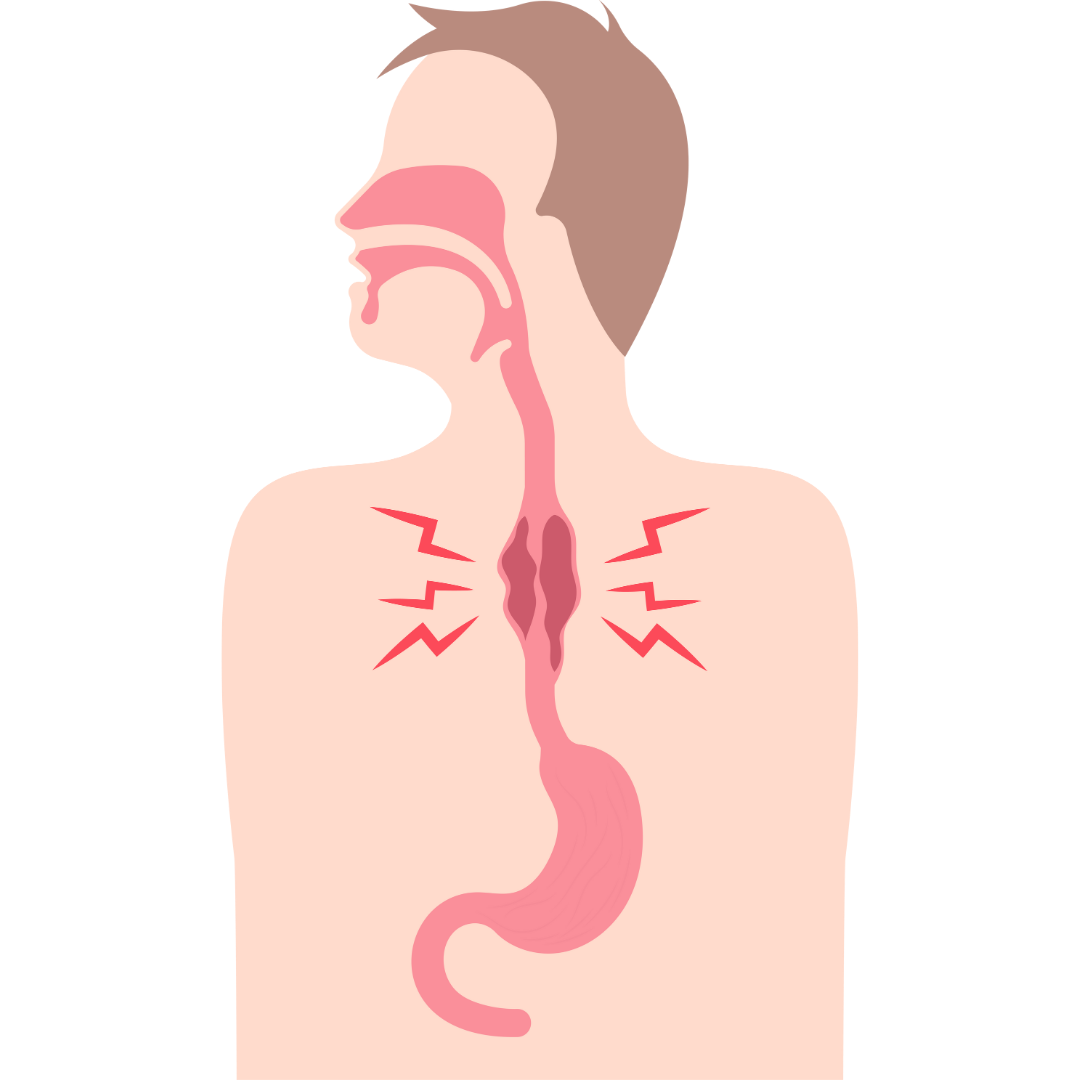 Beana | Funduplicatura